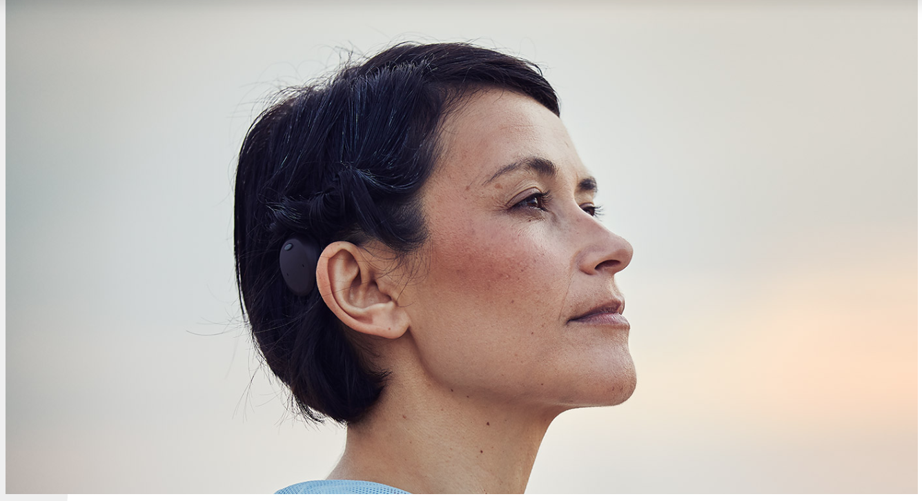 Cochlear Implants & Bone Conduction Solutions - Syracuse Hearing Solutions